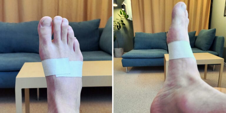 Tejpa hälsporre - så går du tillväga | Gå & Löpkliniken